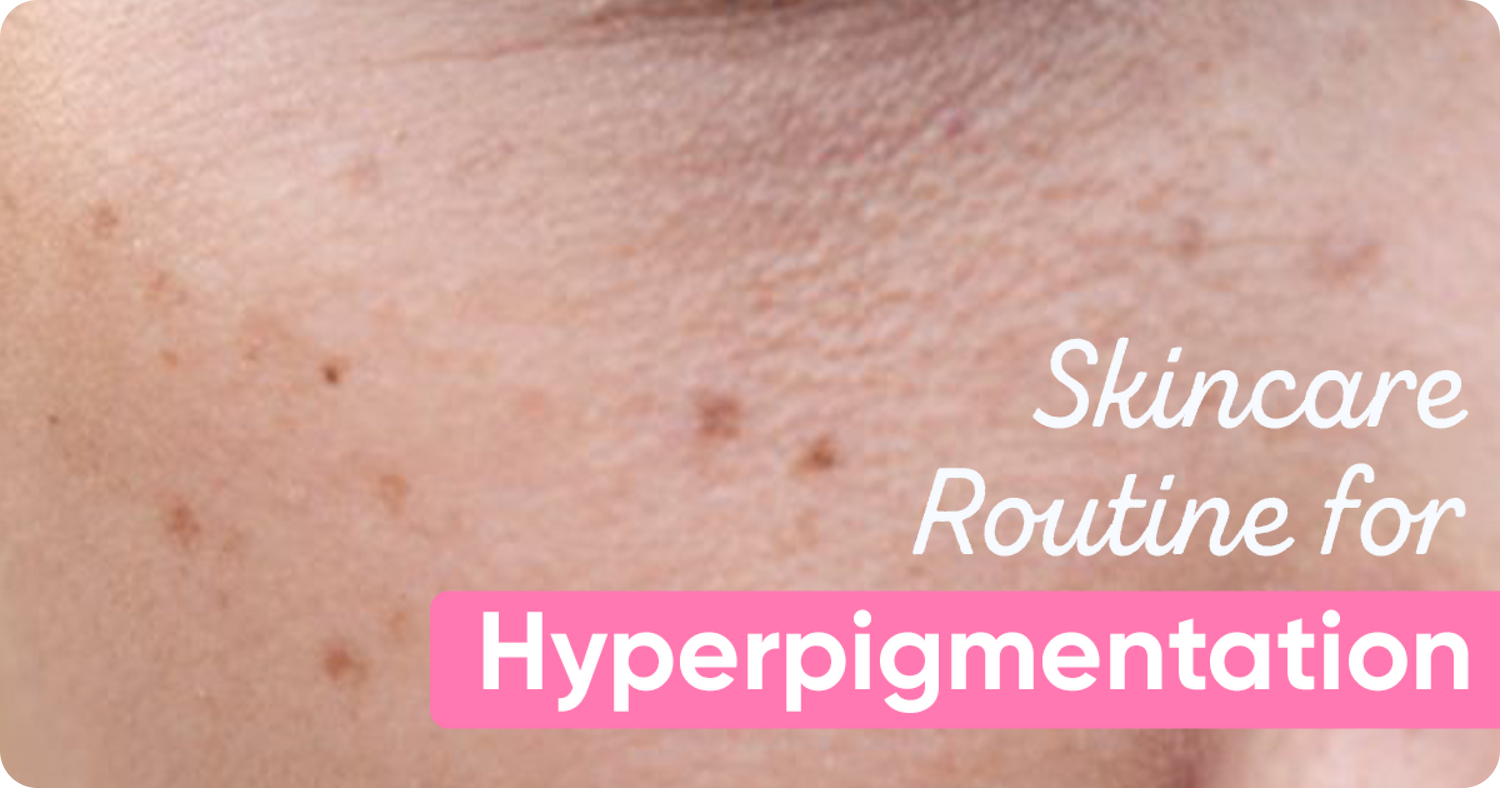 Best Skin Care Routine for Hyperpigmentation (AM & PM)