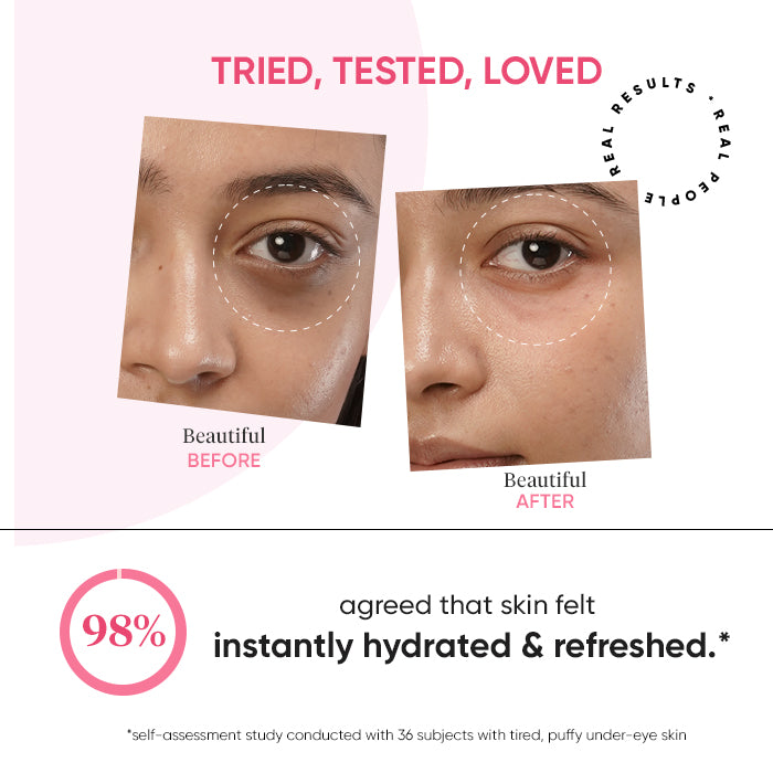 Hydrogel Eye Patches with Watermelon Cooling Effect